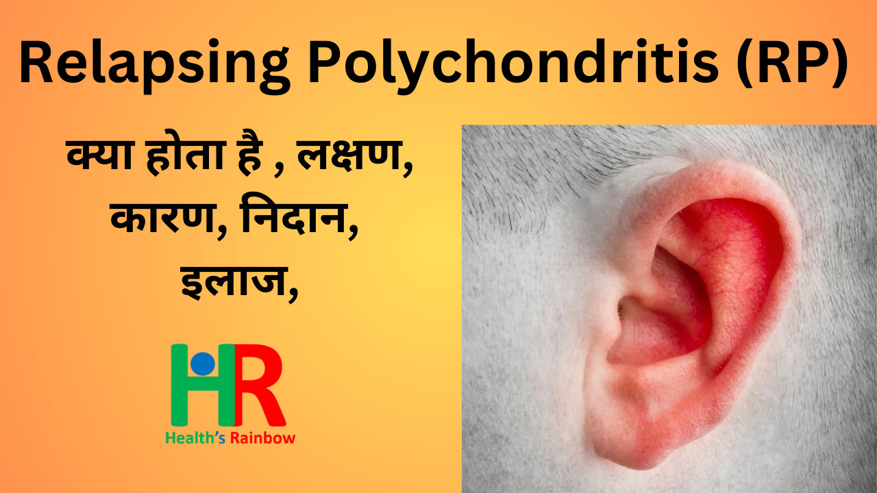 Relapsing Polychondritis: Symptoms, Diagnosis, and Treatment